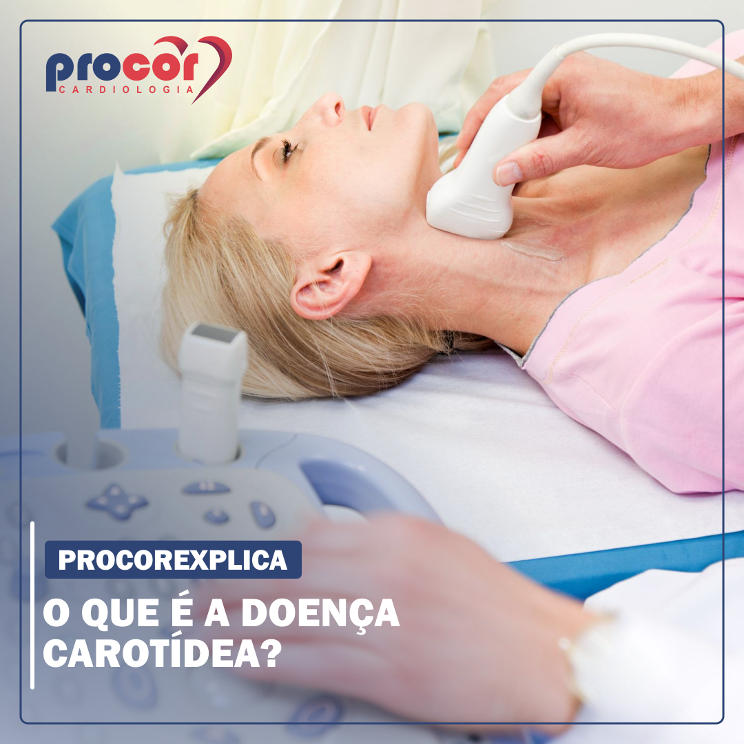 O que é a Doença Carotídea? - Procor Cardiologia